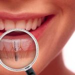 Hove Dental Clinic | Dentist Hove | Dentist Brighton | Cosmetic and Restorative Treatments